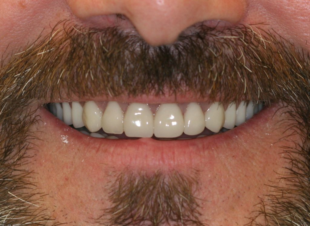 Dentist in Boynton Beach, FL | Eriks Dental Group