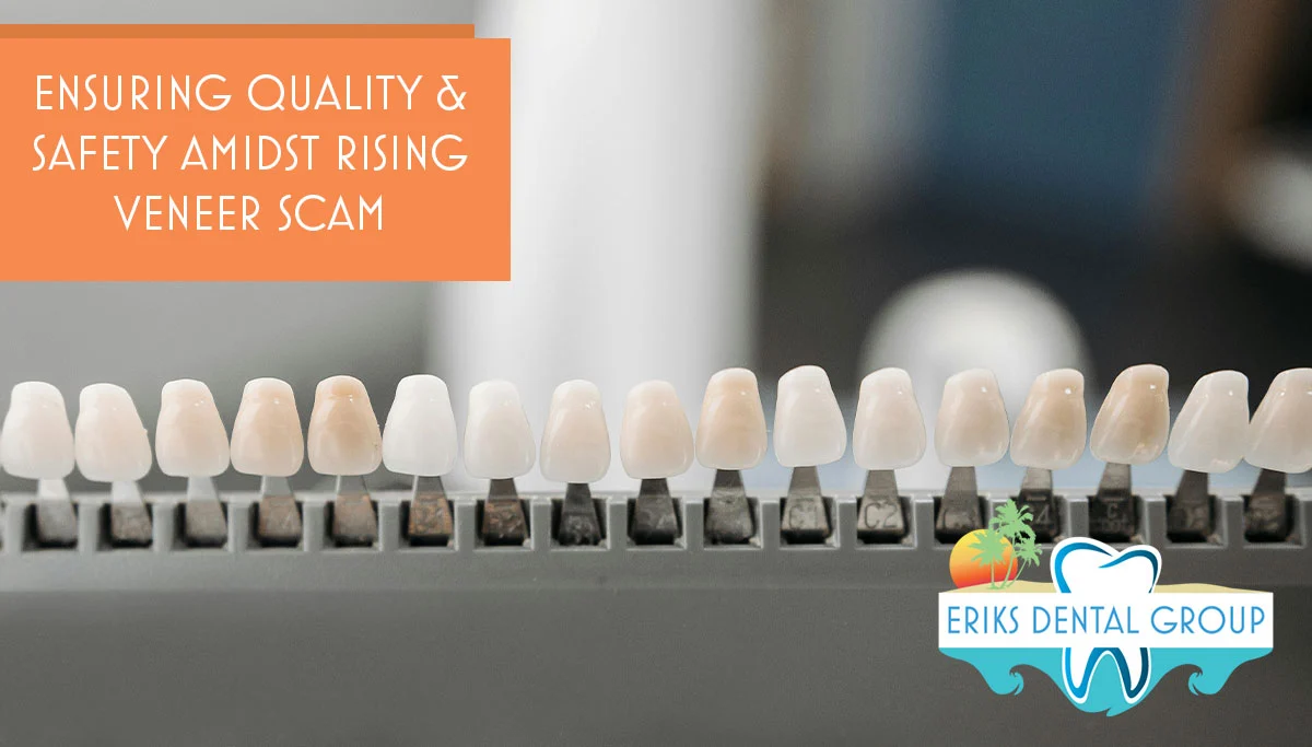 How to Avoid Veneer Scams and Ensure Quality Dental Care